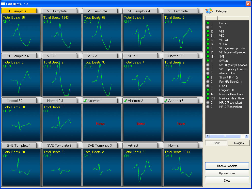 Manual CardioScan - Procesar un estudio Holter