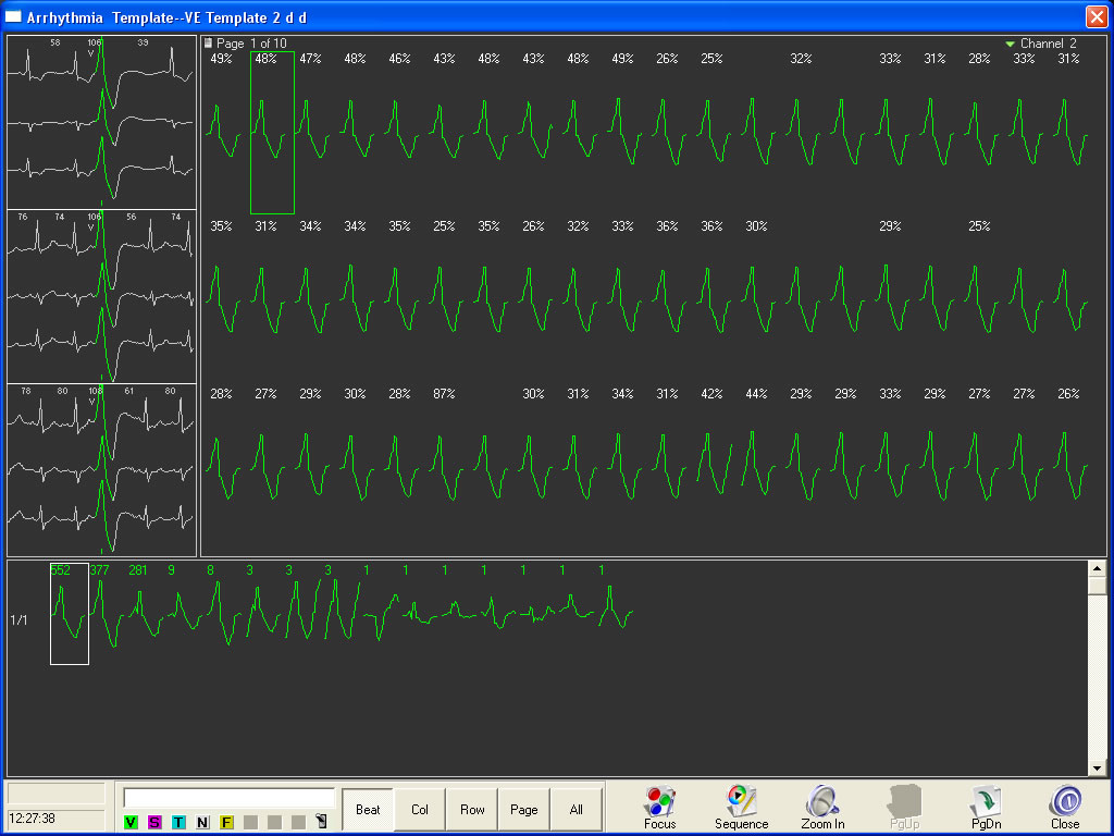Manual CardioScan - Procesar un estudio Holter